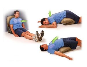 Bronchiectasis - Lung Care Foundation